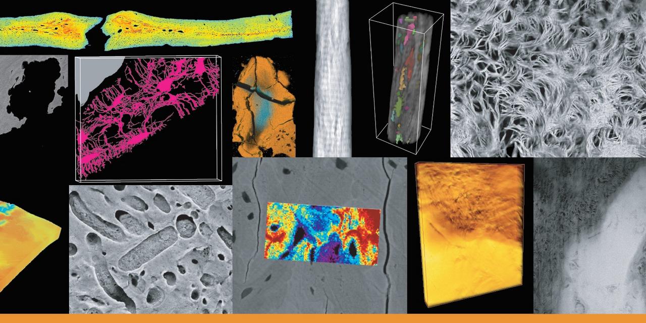 Chiara Micheletti - Multimodal and multiscale characterization of bone ...